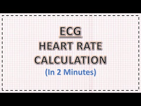 ECG: Heart Rate Calculation | In 2 minutes | ECG Interpretation