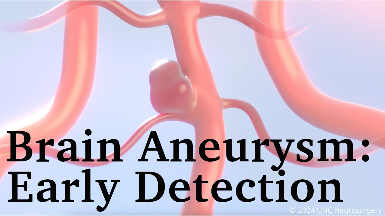 Brain Aneurysms: Early Detection