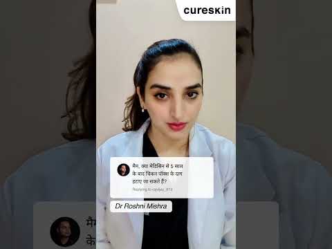 क्या 5 साल पुराने चिकन पॉक्स के दाग हटाए जा सकते हैं? - डॉ. रोशनी मिश्रा | Cureskin