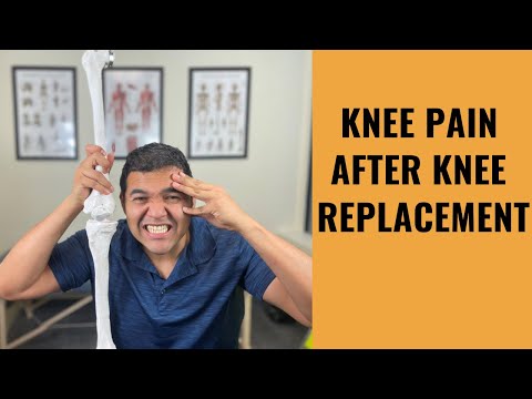 Chronic Knee Pain After Knee Replacement Surgery 3 Common Reasons