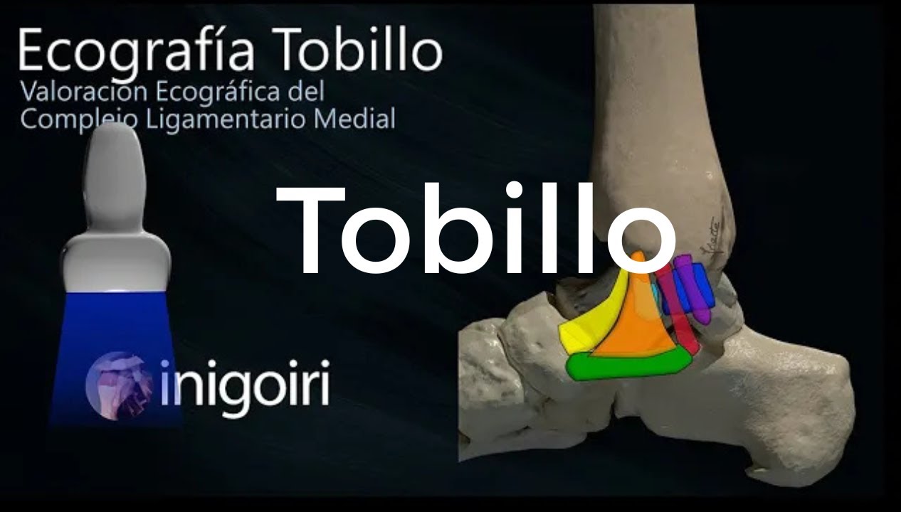ECOGRAFÍA DE TOBILLO | Ligamento Lateral Interno y Ligamento Spring Paso a Paso