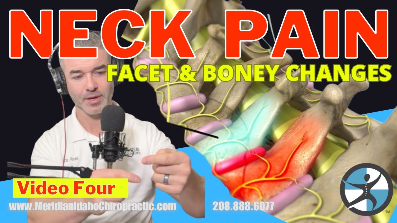 Understanding Neck Pain: The Role of Facet and Bony Changes | Galaxy.ai
