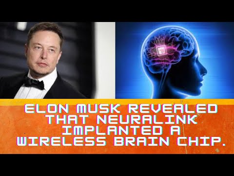 "Facts of the Day" // Elon Musk revealed that Neuralink implanted a wireless brain chip