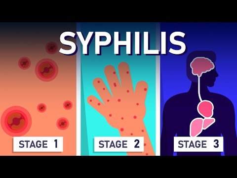 STD: Symptoms, Transmission, and Prevention