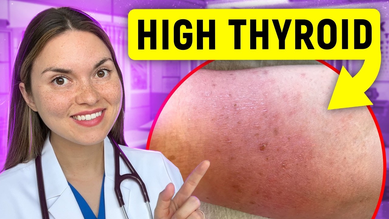 19 Signs of HYPERTHYROIDISM (Graves Disease) You Can See: Doctor Explains