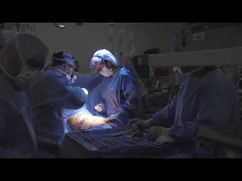 Heart Valve Program | UT Southwestern