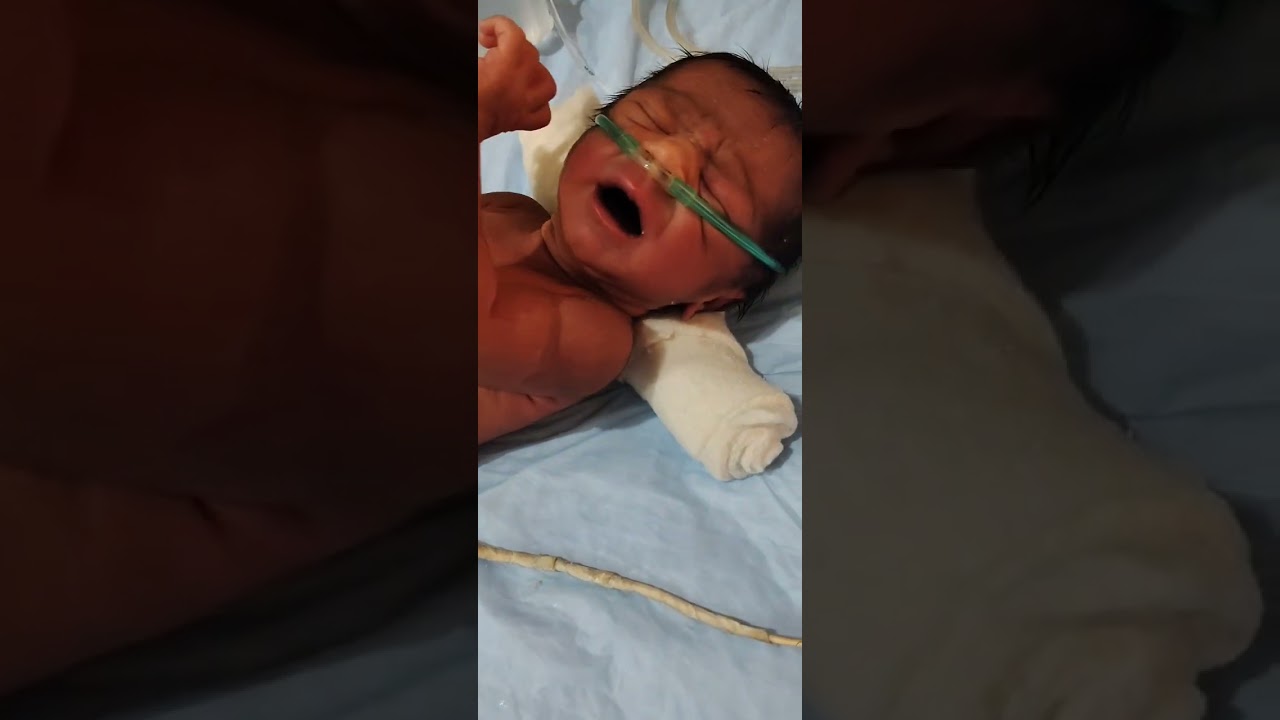 Newborn Baby Seizures with Critical Cry | Emergency NICU Admission🥰👍😘