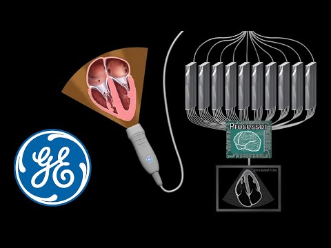 GE Healthcare Cardiovascular Ultrasound – Vmax Animation – Live Healthy ...
