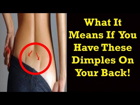 What It Means If You Have These Dimples On Your Back!