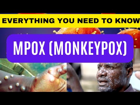 What is MPOX (Monkeypox)? | Monkeypox Outbreak 2024