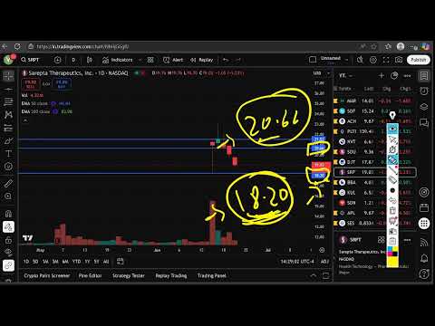 SRPT Stock (Sarepta Therapeutic stock) SRPT STOCK PREDICTION SRPT STOCK analysis SRPT stock news