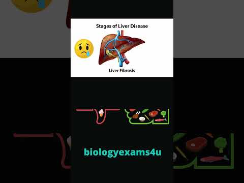 Stages of Liver Diseases