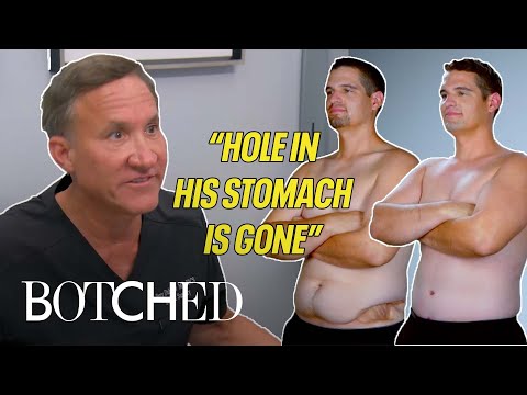 UNBELIEVABLE Botched Life Changing Transformations (BEFORE & AFTERS) | Botched | E!
