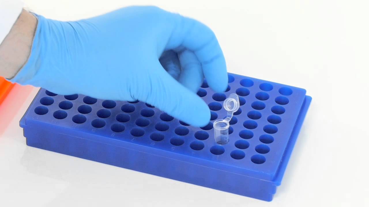 iCE Sample Preparation Video | Bio-Techne