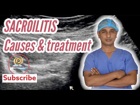 SACROILITIS -Common Cause of low back pain | #sacroiliitis #lowbackpain #causes #PainfixRx