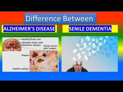 ALZHEIMER'S DISEASE Vs. SENILE DEMENTIA