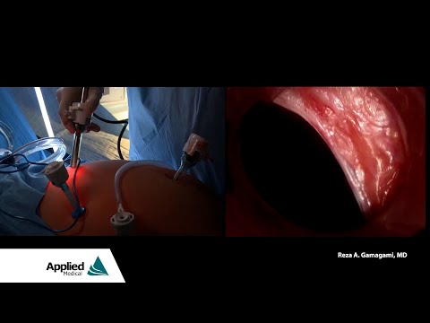 Tissue Reapproximation | Featuring the Kii Optical 11mm Obturator