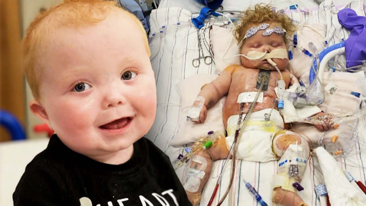 Baby's Heart Transplant Makes Medical History