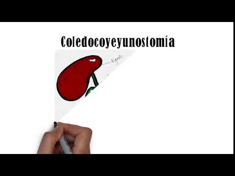 Spanish Medical Interpreter-Spanish Medical Terminology-How Pronounce Choledochojejunostomy Spanish
