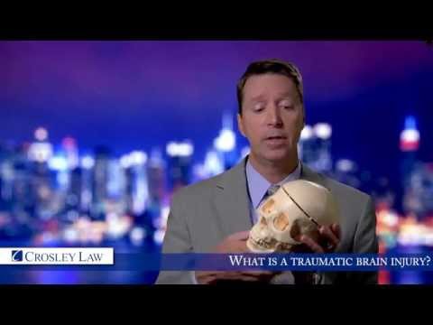 FAQ: What Is A Traumatic Brain Injury?