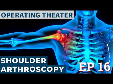 What is Shoulder Arthroscopy? - Operating Theater Ep.16