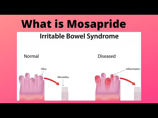 Antacid And Gastrointestinal Drug - Esoprazole ESOHEAL 40 MG Service ...