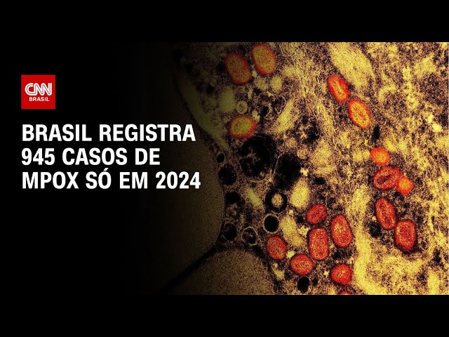 Mpox: Brasil registra 945 casos desde o começo do ano e ultrapassa ...