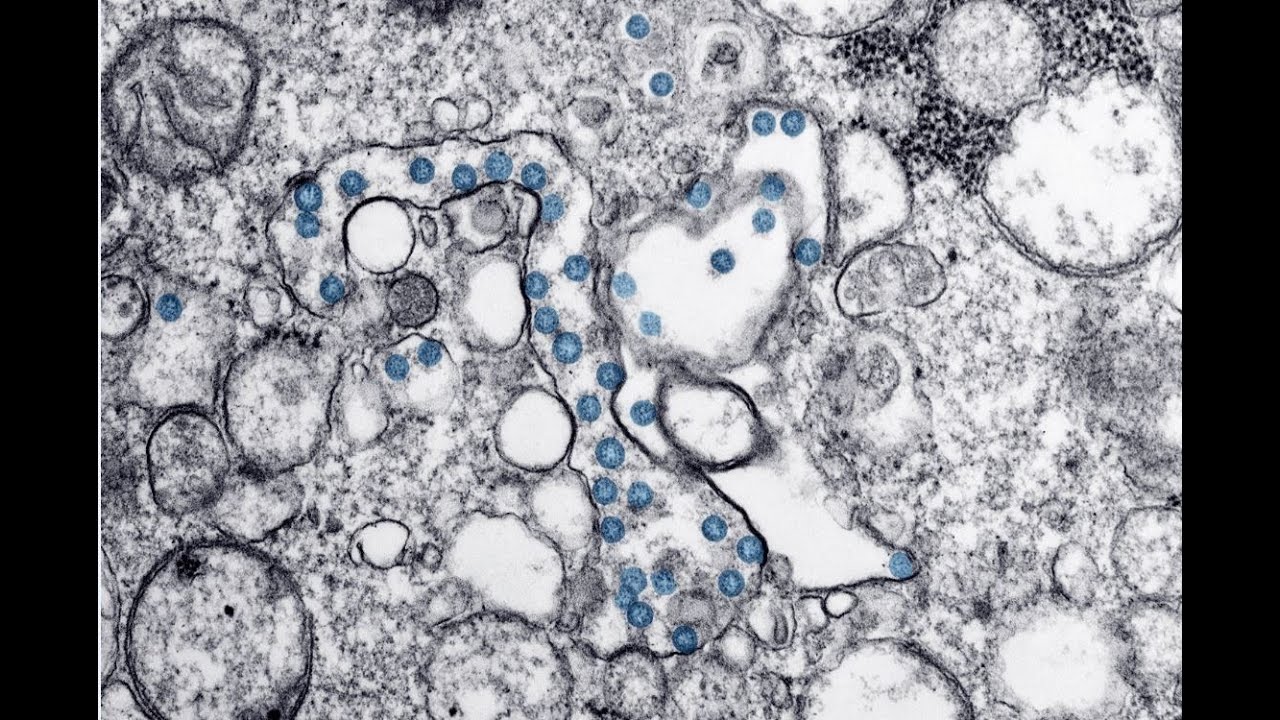 #WashWeekPBS: How the U.S. is preparing for a possible novel coronavirus outbreak?