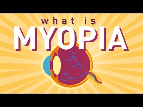 What is Myopia (Short sightedness)?