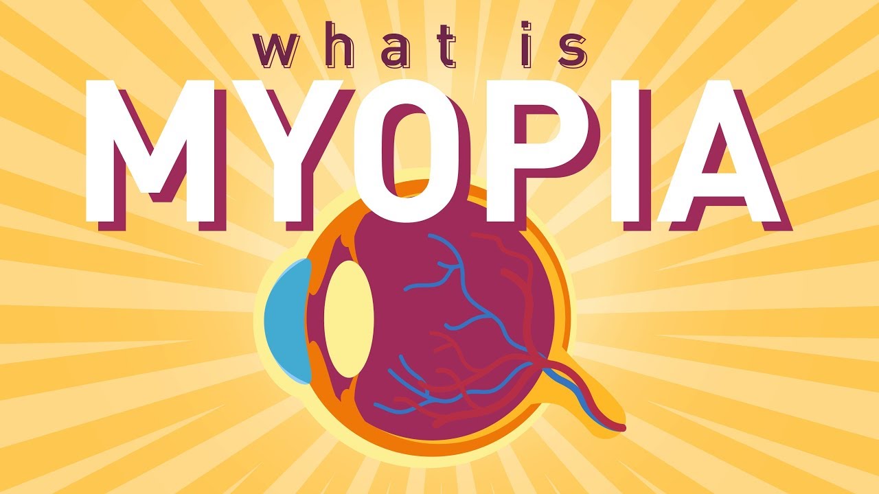 What is Myopia (Short sightedness)?