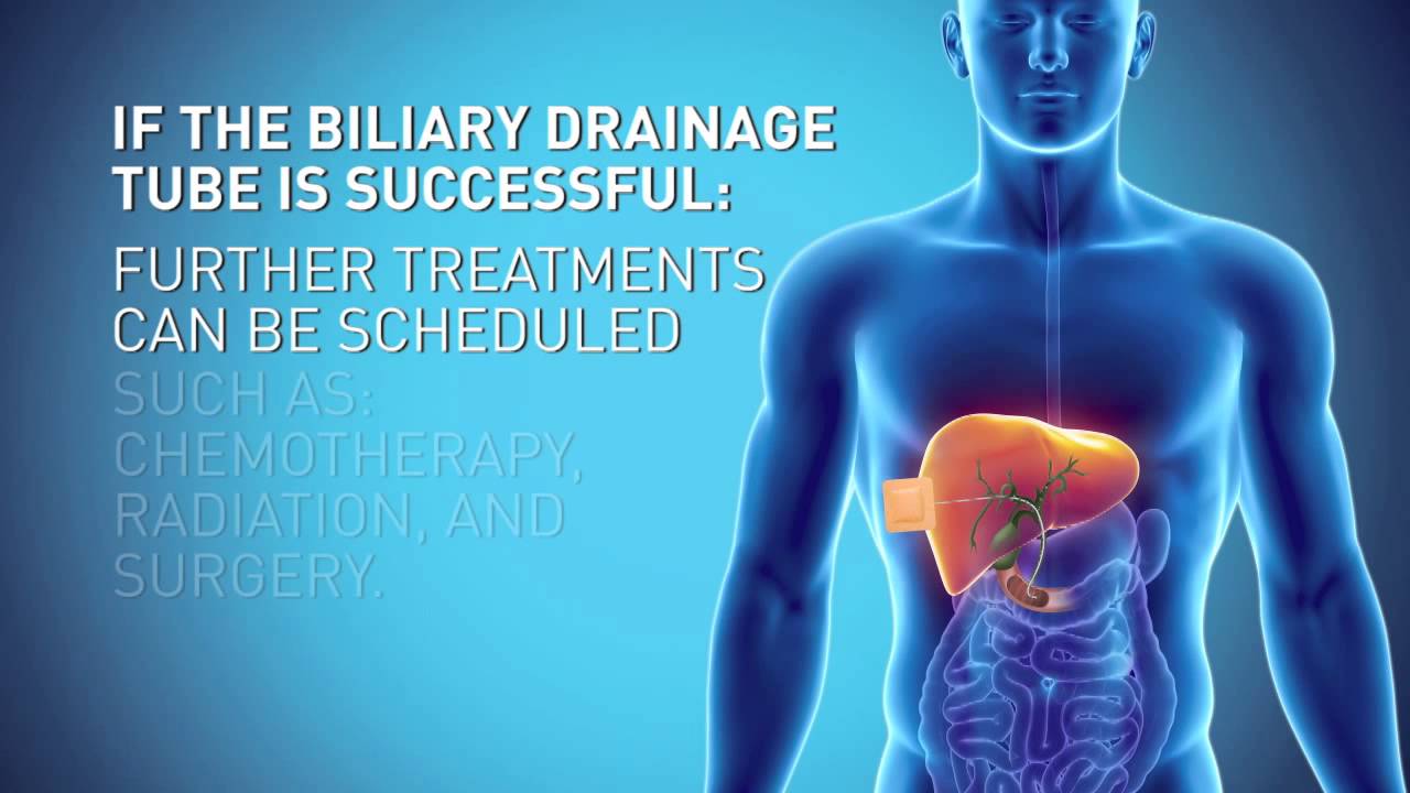 Biliary Drain