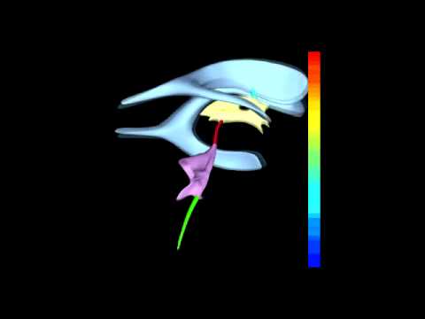 Ventricular System of the Brain - Anatomy