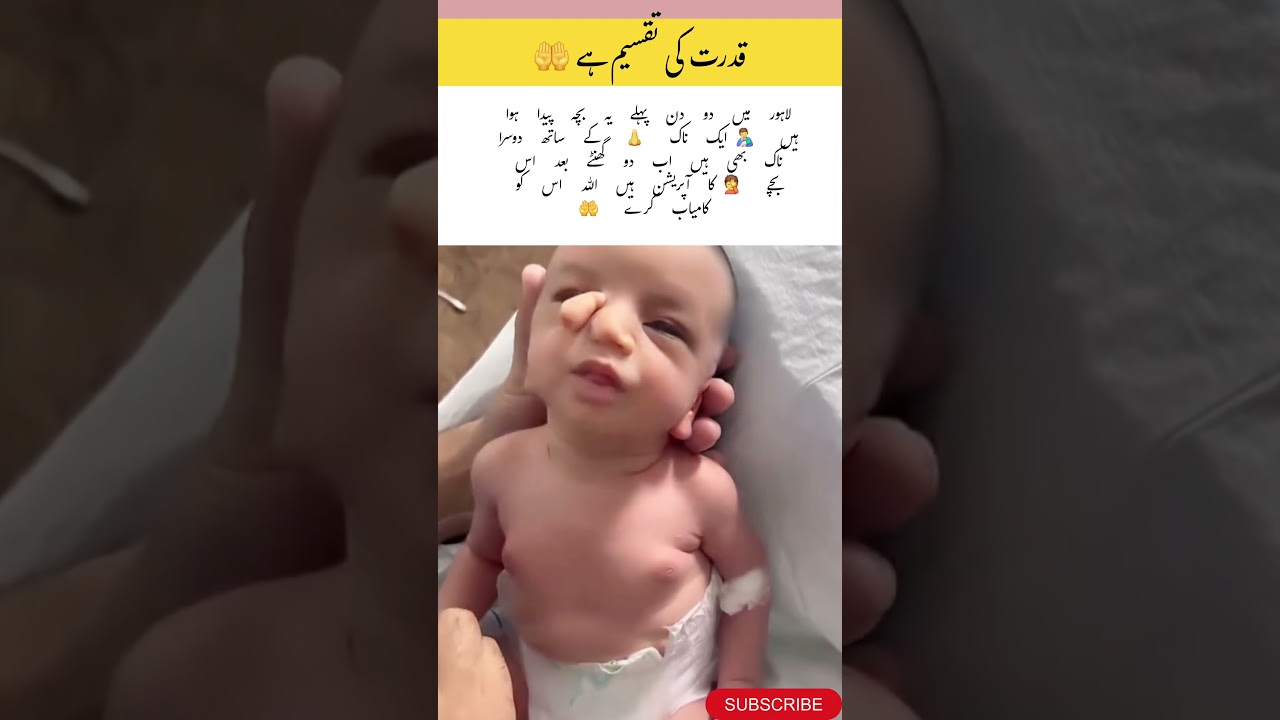 Innocent baby undergoes surgery two hours later #innocent #child #baby #surgery #hospital #life#fyp