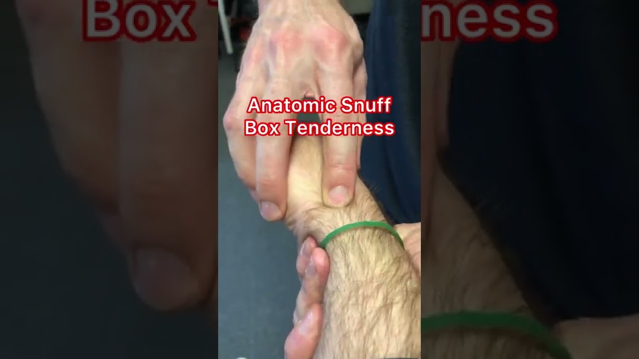 Scaphoid Fracture Examination | Special Test | Snuff Box