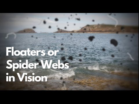 Seeing Floaters or Spider Webs in Vision - EXPLAINED! | Dr. D'Orio Eyecare