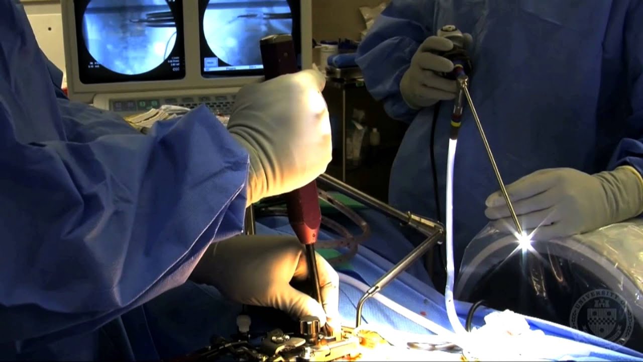 Lateral lumbar interbody fusion