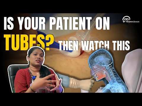 What is the best for your patient - NG Tube? PEG Tube? Watch to find out |