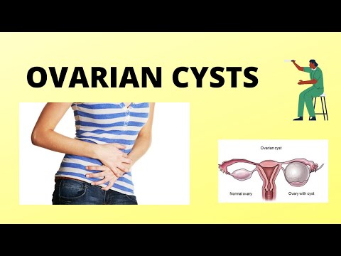 OVARIAN TUMOURS - GENERAL IDEA - RISK OF MALIGNANCY INDEX ; FUNCTIONAL CYSTS