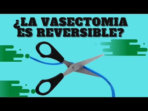Vasectomia reversible - Vasectomía ¿Qué es y cómo revertirla?