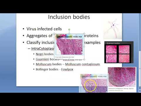 Cowdry Type B Inclusion Bodies
