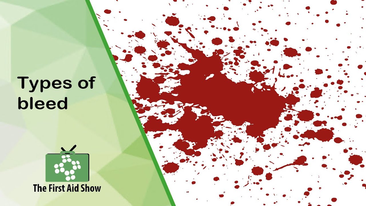 Types of bleed on The First Aid Show