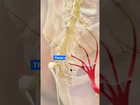 Is SI Joint the reason for your sciatica ?!