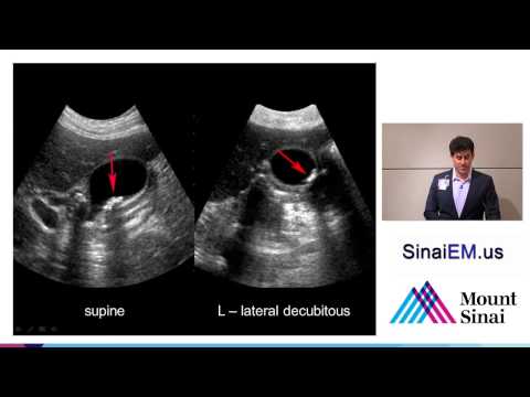 05 Gallbladder