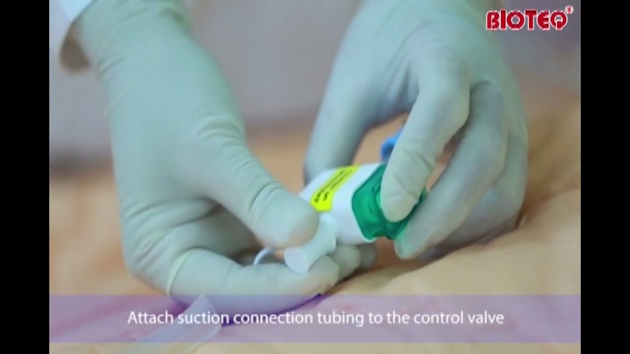 BIOTEQUE CLOSED SUCTION CATHETER INTRODUCTION
