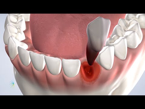 Pre-Operative Instructions: General | Oral Surgery Specialists of Oklahoma
