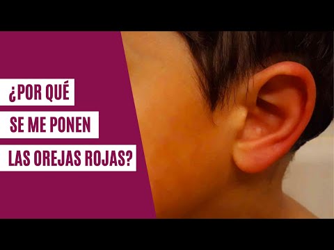 ¿Por qué se me ponen las orejas rojas?