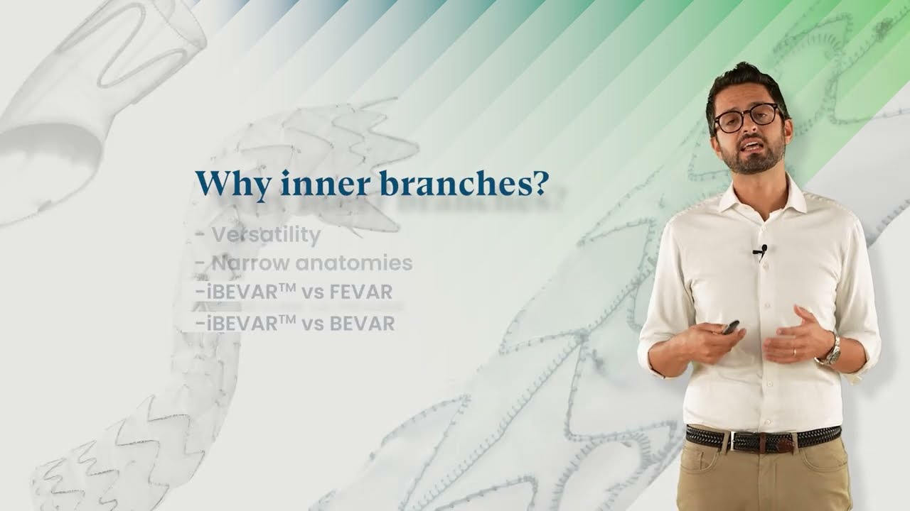 E-nside™ TAAAMultibranch Stent Graft System video tutorial