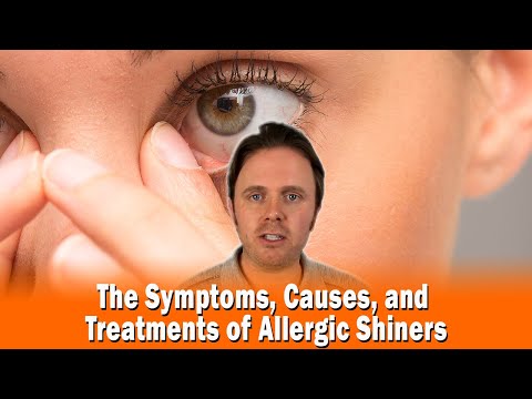 The Symptoms, Causes, and Treatments of Allergic Shiners