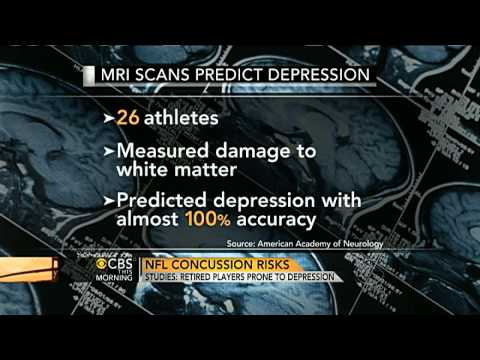 New studies expand on NFL concussion risks