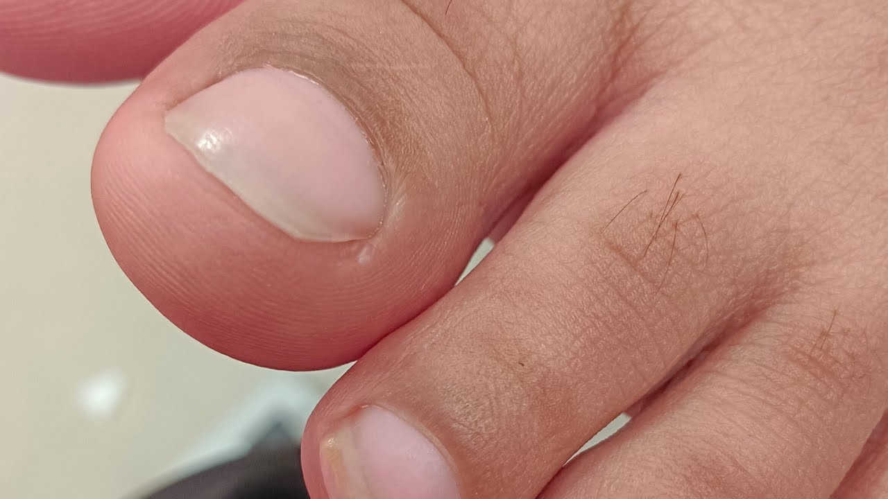 Pedicure Again #satisfying Neldz SOLO Parent  is live!